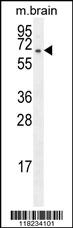 FBXO21 Antibody - Cat. No. 55-784 | ProSci
