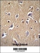 FBXO21 Antibody - Cat. No. 55-784 | ProSci