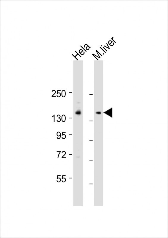 LMTK3 Antibody - Cat. No. 55-905 | ProSci