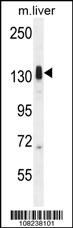 LMTK3 Antibody - Cat. No. 55-905 | ProSci