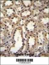 GPC6 Antibody - Cat. No. 55-977 | ProSci