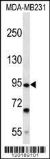 FSD2 Antibody - Cat. No. 56-319 | ProSci