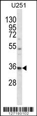 VPS37B Antibody - Cat. No. 56-419 | ProSci