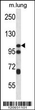 CTNND2 Antibody - Cat. No. 56-497 | ProSci