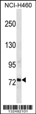RFX2 Antibody - Cat. No. 56-666 | ProSci