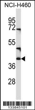 CD1C Antibody - Cat. No. 57-038 | ProSci
