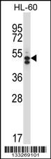HDAC7 Antibody - Cat. No. 57-176 | ProSci
