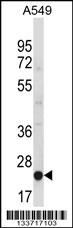 MBL2 Antibody - Cat. No. 57-234 | ProSci