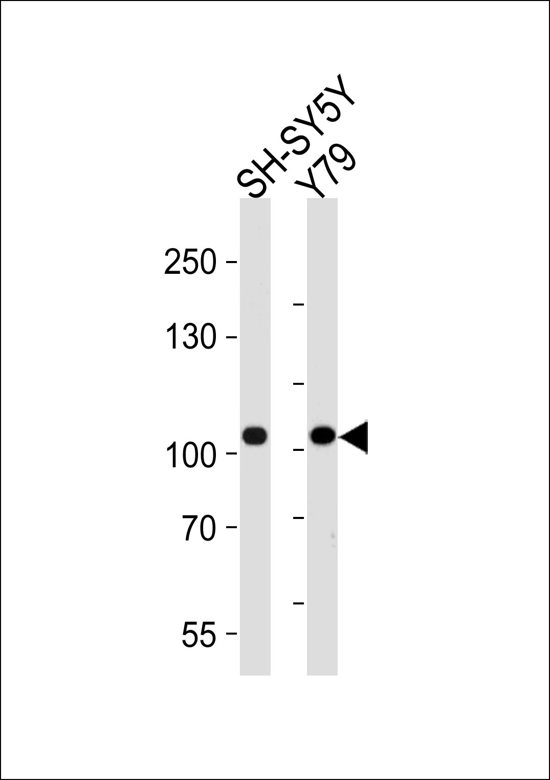 CDH8 Antibody - Cat. No. 57-427 | ProSci