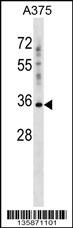 PSG2 Antibody - Cat. No. 58-793 | ProSci