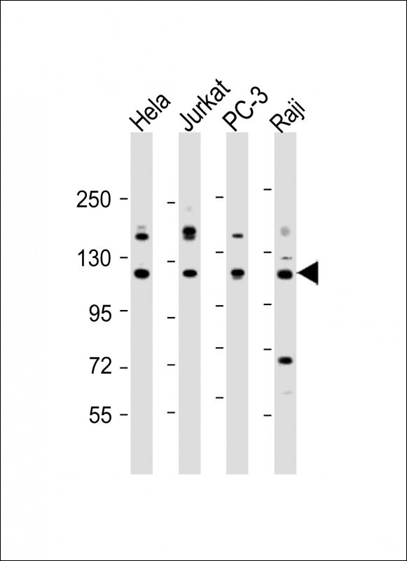 REST Antibody - Cat. No. 58-859 | ProSci