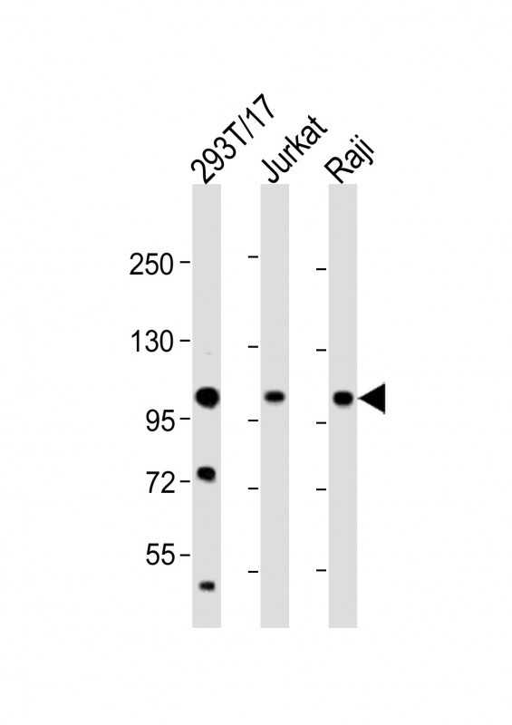 REST Antibody - Cat. No. 58-859 | ProSci