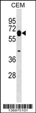 MYOT Antibody - Cat. No. 59-047 | ProSci