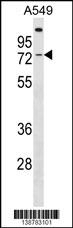 GBP3 Antibody - Cat. No. 59-897 | ProSci