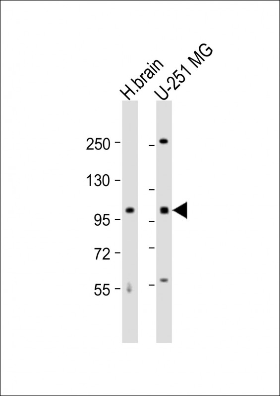 MBD6 Antibody - Cat. No. 60-195 | ProSci