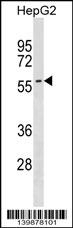 SMPD3 Antibody - Cat. No. 60-306 | ProSci