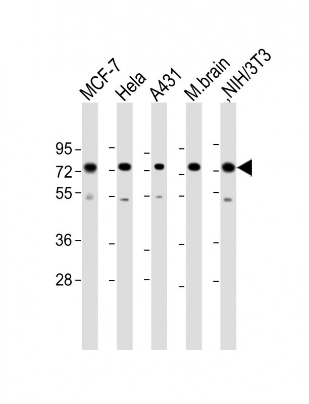 MTA1 Antibody - Cat. No. 60-671 | ProSci