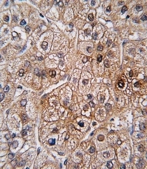 BMPR2 Antibody - Cat. No. 60-854 | ProSci