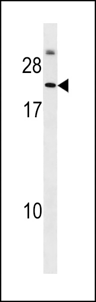 Podoplanin / GP36 / T1A-2 Antibody - Cat. No. 60-906 | ProSci