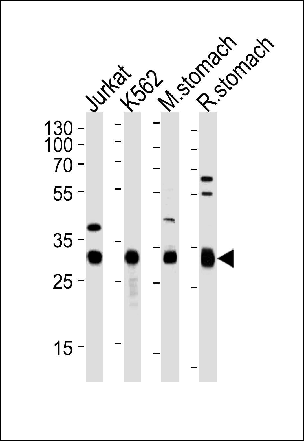 ESD Antibody - Cat. No. 61-014 | ProSci