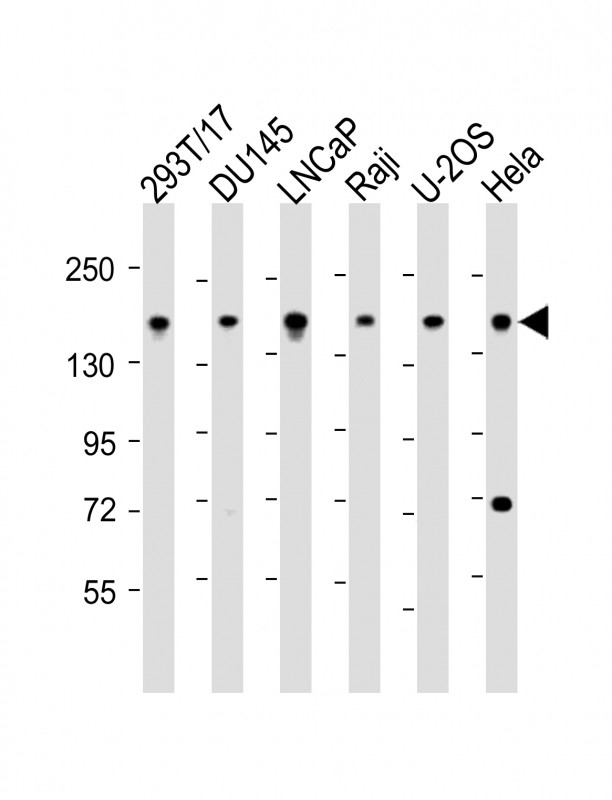 PDS5B Antibody - Cat. No. 61-175 | ProSci