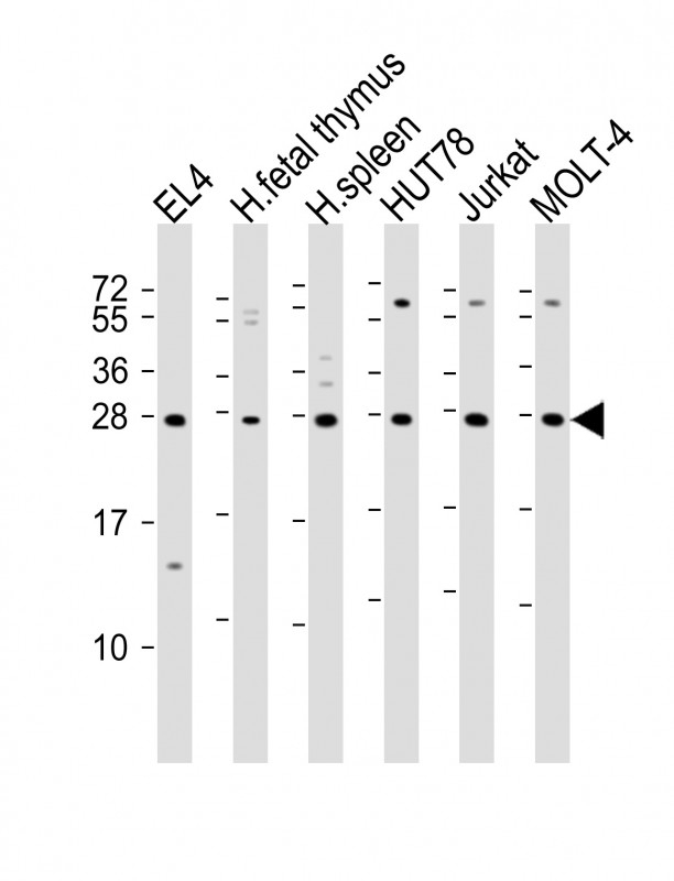 TIGIT Antibody - Cat. No. 61-342 | ProSci