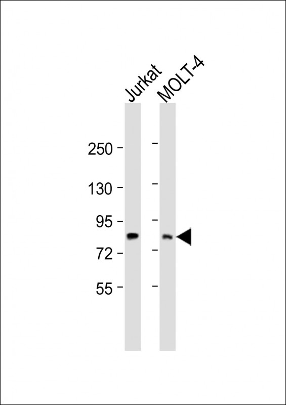 LCP2 Antibody - Cat. No. 61-352 | ProSci