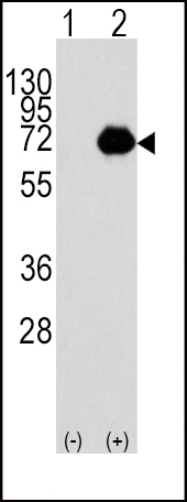 ACOX1 Antibody - Cat. No. 61-412 | ProSci