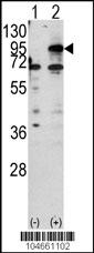 CPT1B Antibody - Cat. No. 61-417 | ProSci