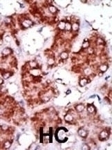 CPT1B Antibody - Cat. No. 61-417 | ProSci