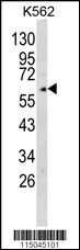 GPC4 Antibody - Cat. No. 61-505 | ProSci