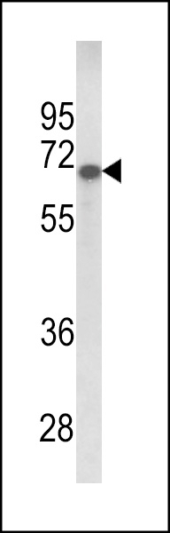 GPC4 Antibody - Cat. No. 61-505 | ProSci