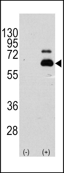 S6K Antibody - Cat. No. 61-628 | ProSci