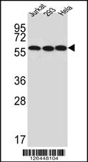 UTP6 Antibody - Cat. No. 61-874 | ProSci