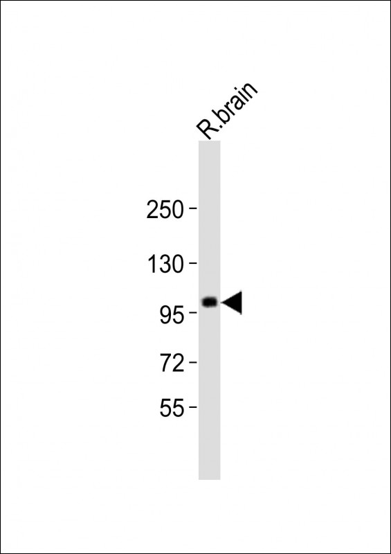 ST18 Antibody - Cat. No. 61-909 | ProSci