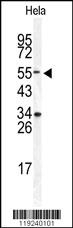 DONSON Antibody - Cat. No. 62-001 | ProSci
