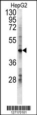 LDHD Antibody - Cat. No. 62-026 | ProSci