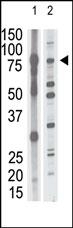 MMP15 Antibody - Cat. No. 62-172 | ProSci