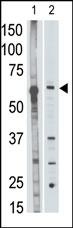 MMP25 Antibody - Cat. No. 62-178 | ProSci