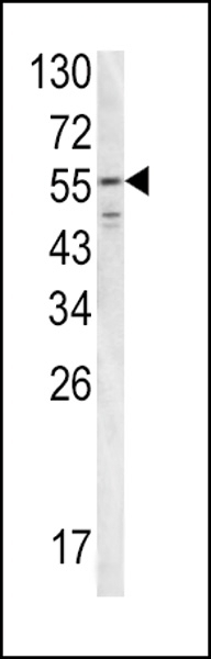 FIBB Antibody - Cat. No. 62-293 | ProSci