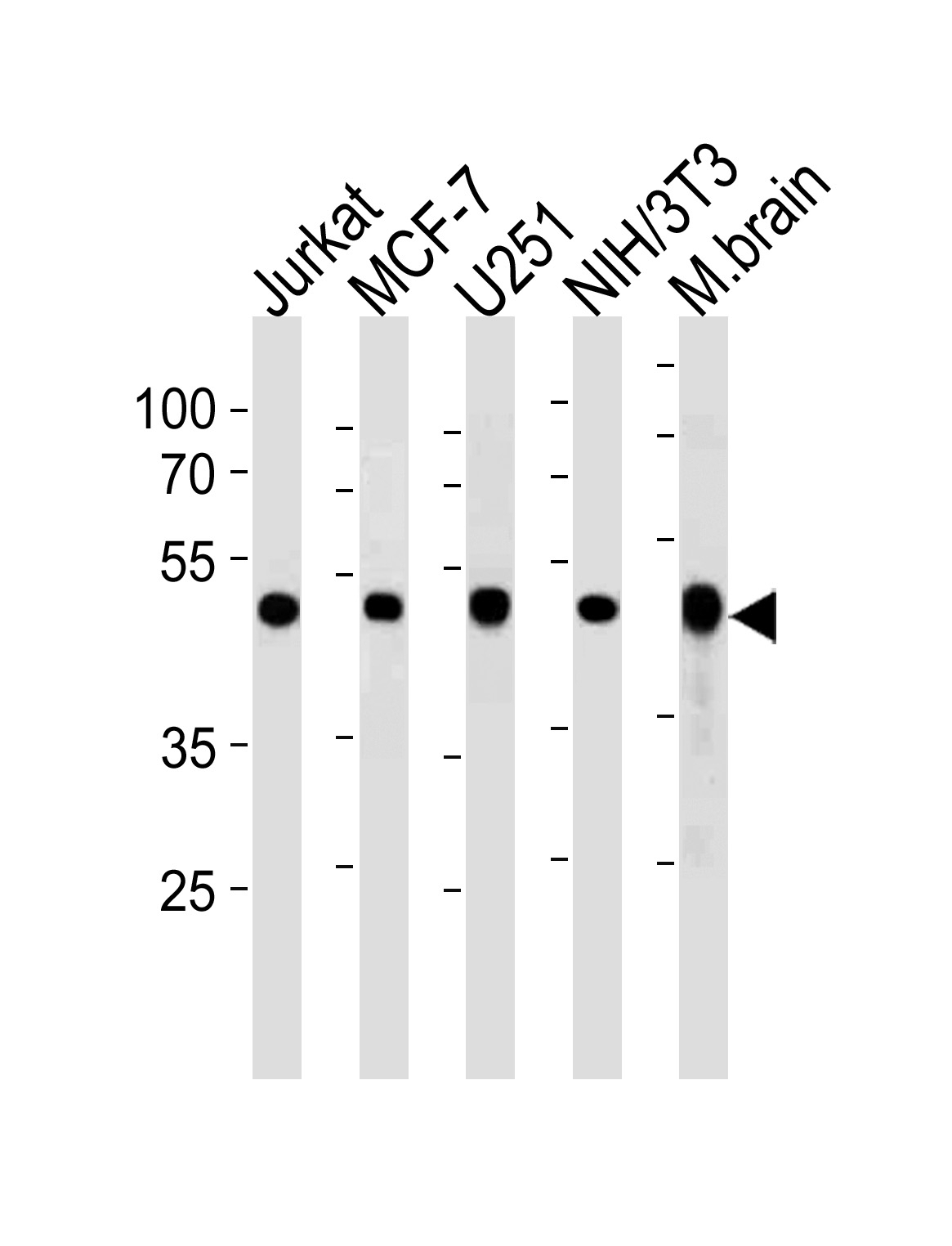 ENO1 Antibody - Cat. No. 62-302 | ProSci