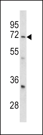 GARP Antibody - Cat. No. 62-378 | ProSci