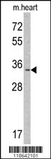 MLF1 Antibody - Cat. No. 62-424 | ProSci
