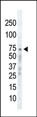 ADRBK1 Antibody - Cat. No. 62-582 | ProSci