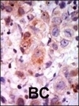 ADRBK1 Antibody - Cat. No. 62-582 | ProSci