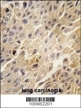 ADRBK1 Antibody - Cat. No. 62-582 | ProSci