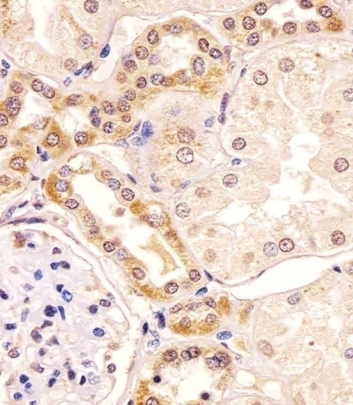 PKC beta1/2 Antibody - Cat. No. 62-591 | ProSci