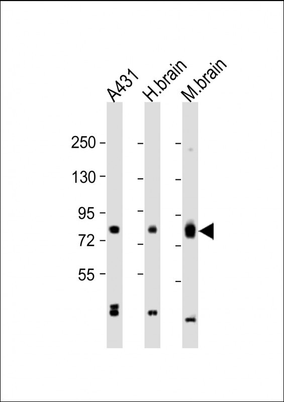 PKC beta1/2 Antibody - Cat. No. 62-591 | ProSci