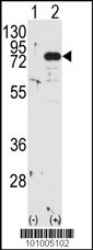PKC beta1/2 Antibody - Cat. No. 62-591 | ProSci