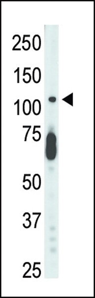 CDKL5 Antibody - Cat. No. 62-757 | ProSci